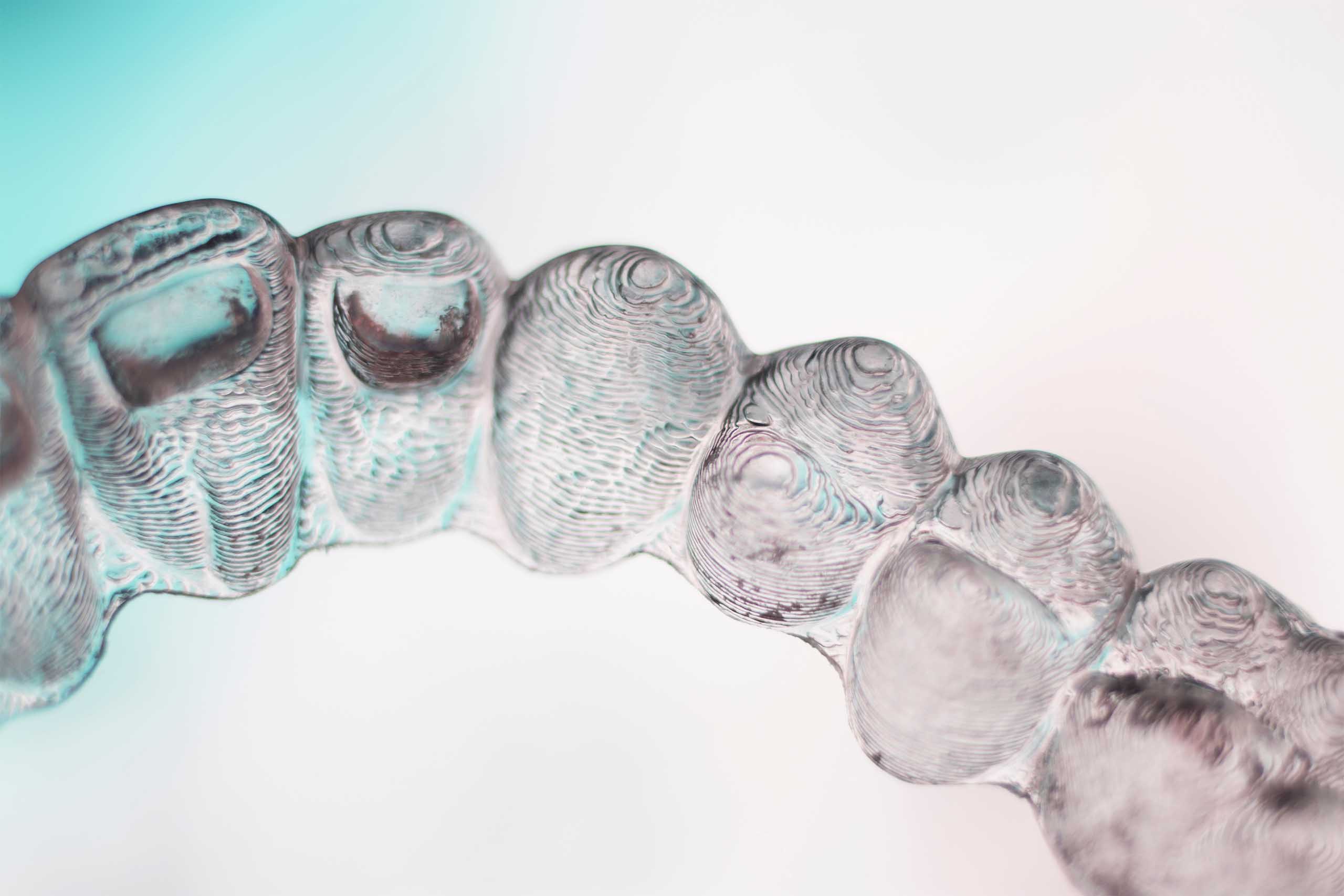 Antibacterial 3D printed tooth - South Steet Dental
